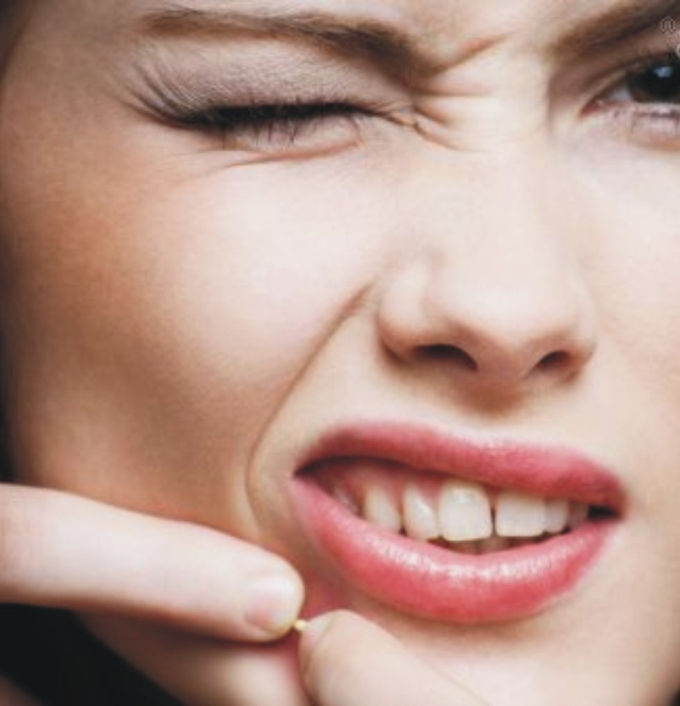 Acne - Corrective Treament by Dr. Walton